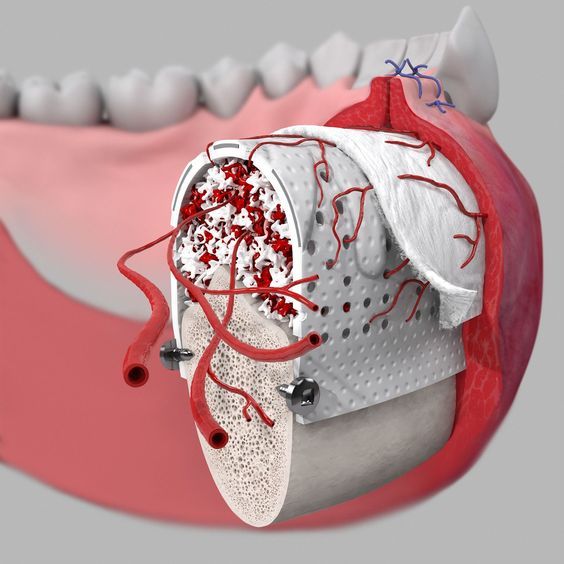 Exploring the Dynamic Growth of the Dental Biological Barrier Membrane ...